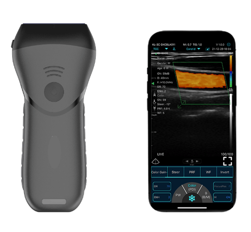 Ultrasound Machines | Real Time Ultrasound
