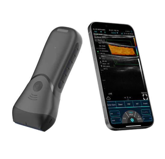 C10TX Dual Head Convex & Linear Wireless Hand Held Ultrasound Machine ...