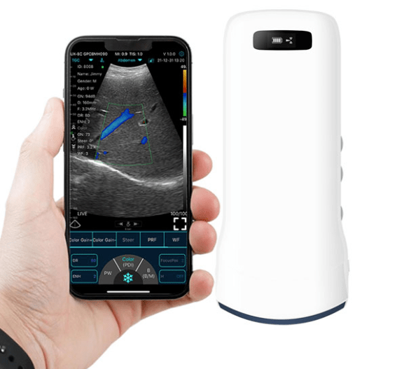 Ultrasound Machines | Real Time Ultrasound